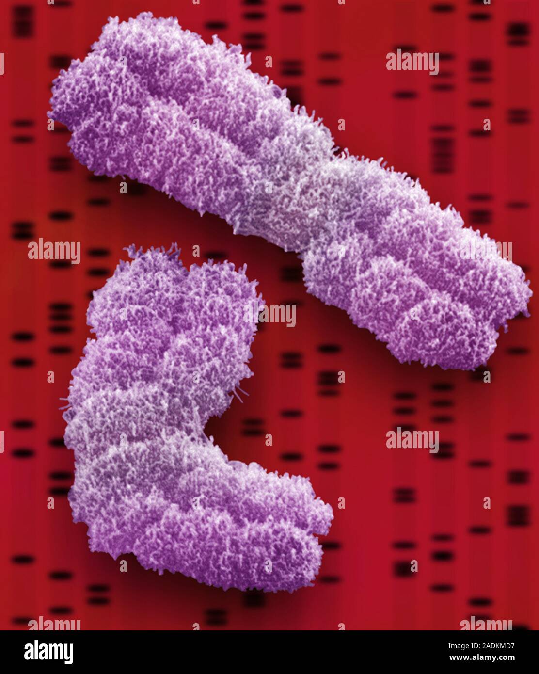 Chromosomes. Coloured scanning electron micrograph (SEM) of two ...