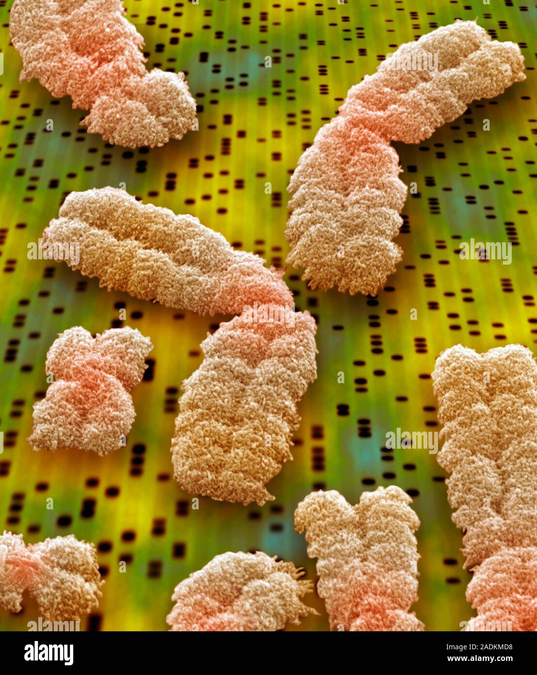 Chromosomes. Coloured scanning electron micrograph (SEM) of chromosomes ...
