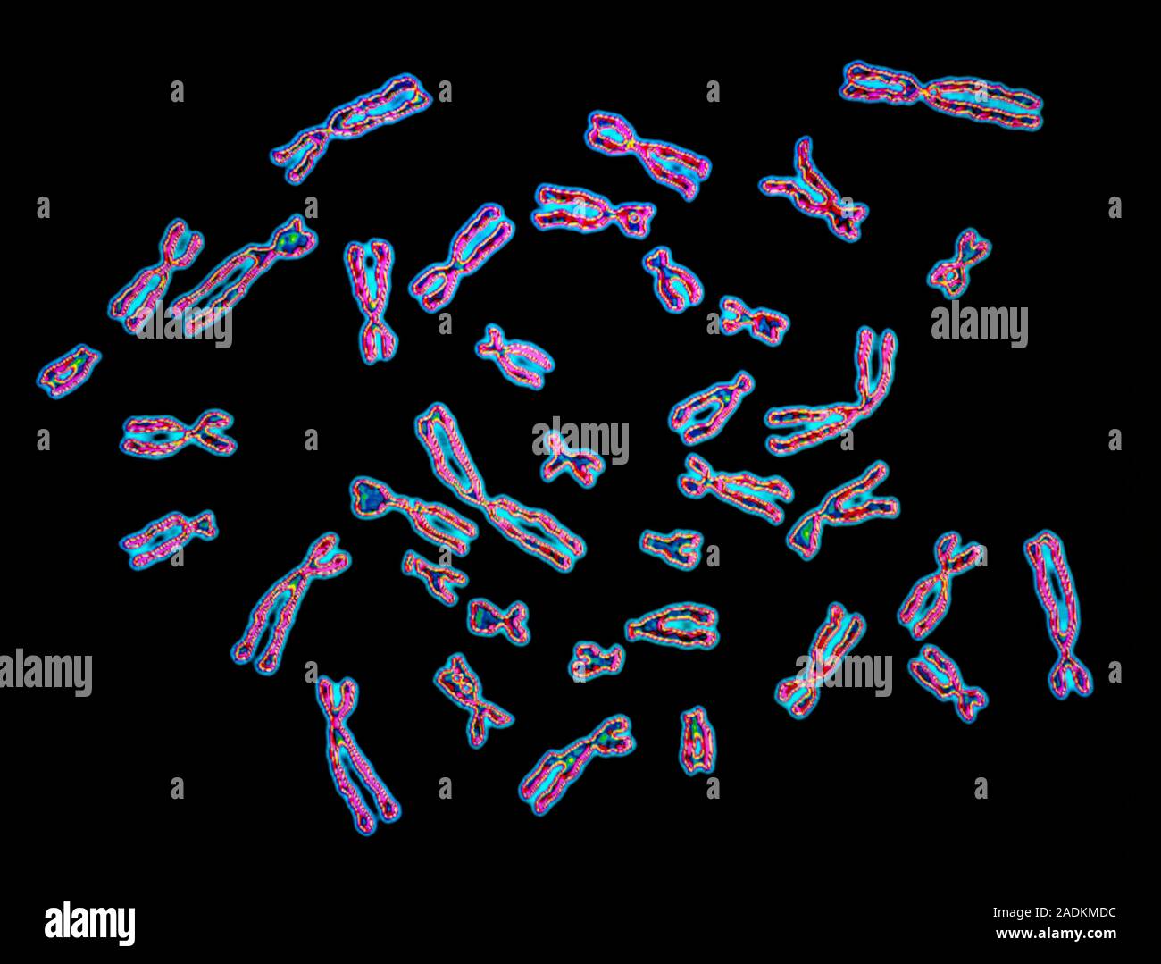 Human chromosomes, coloured light micrograph. Each chromosome comprises ...