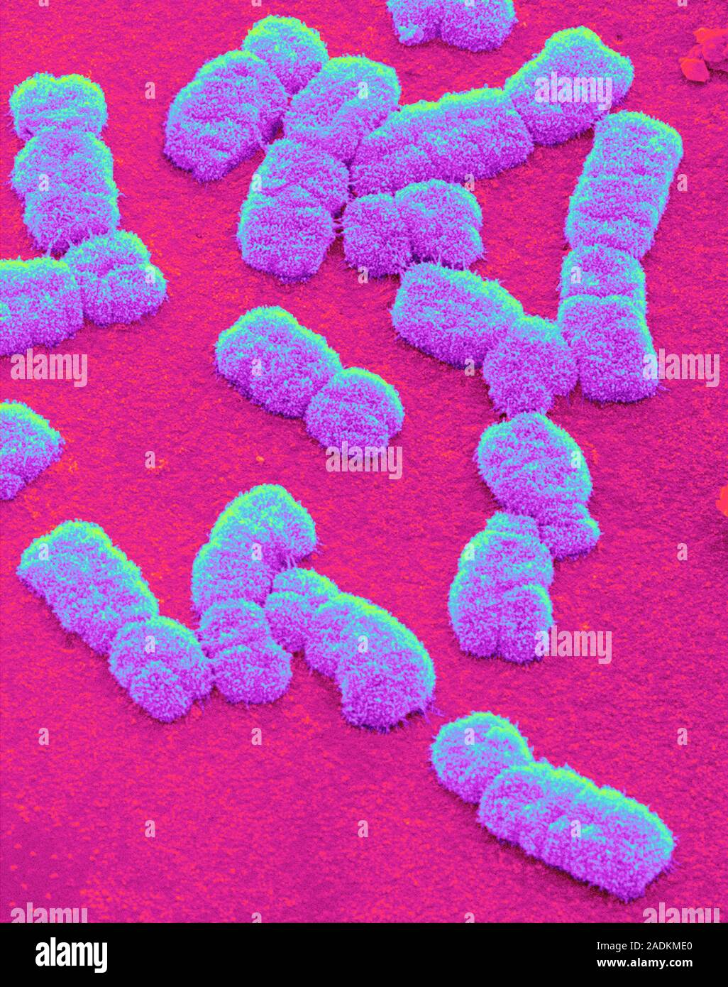Human chromosomes. Coloured scanning electron micrograph (SEM) of human ...