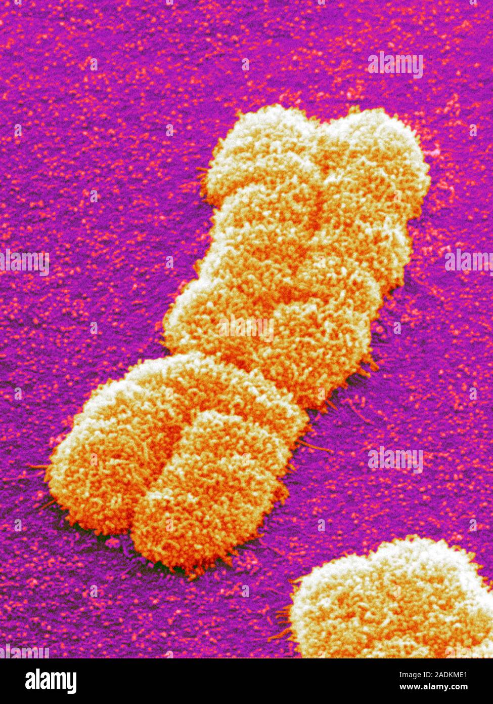 Human chromosome. Coloured scanning electron micrograph (SEM) of a ...