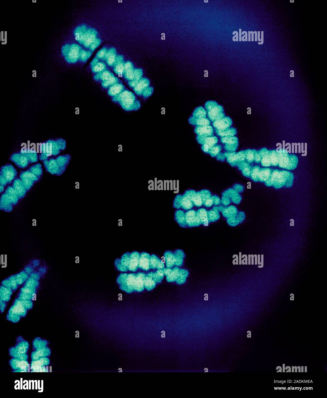 Human chromosomes. Coloured scanning electron micrograph (SEM) of ...