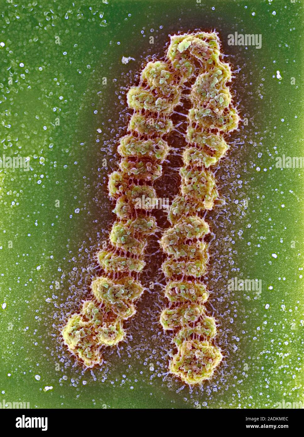 Chromosome. Coloured scanning electron micrograph (SEM) of a condensed ...