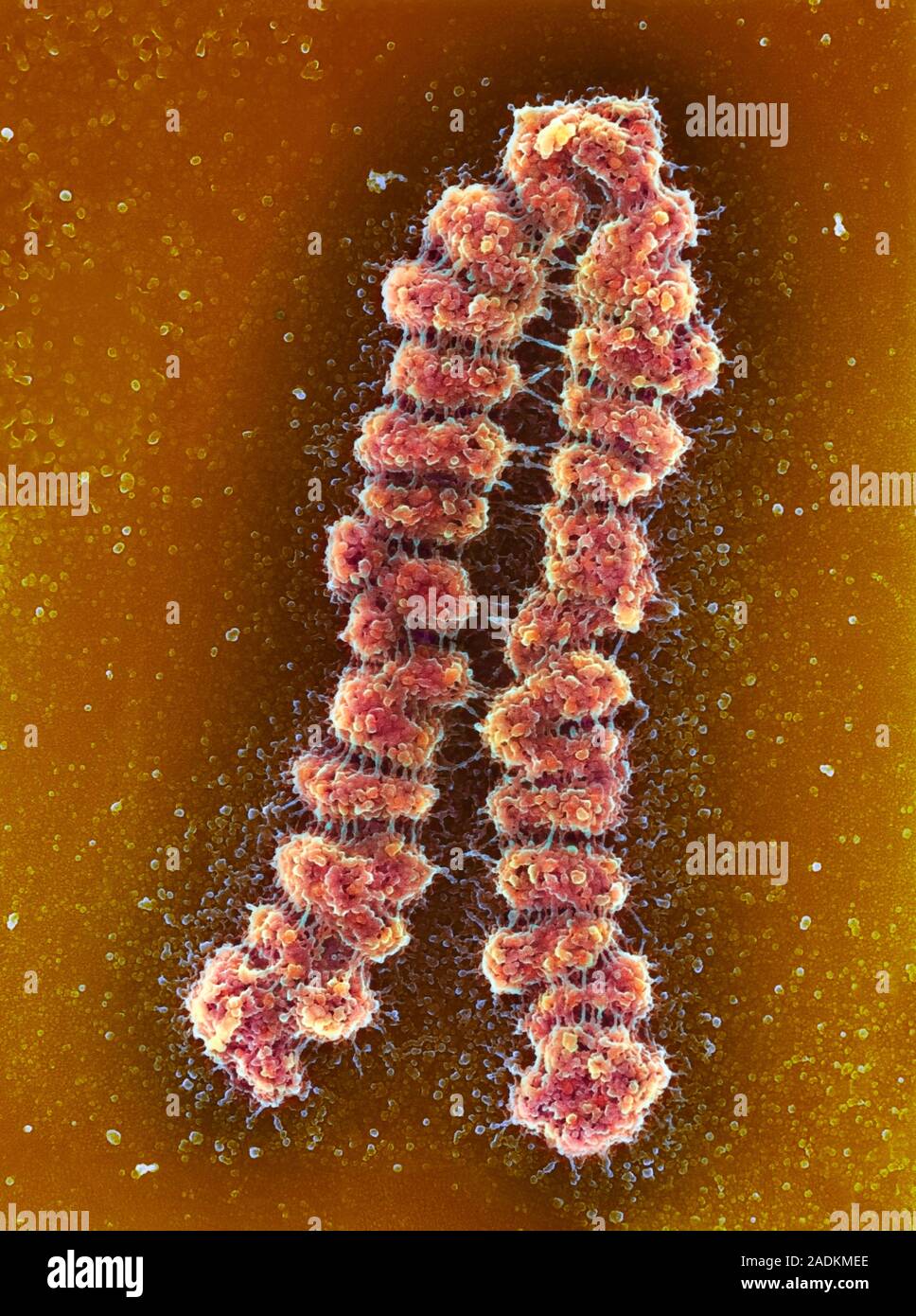 Chromosome. Coloured scanning electron micrograph (SEM) of a condensed ...