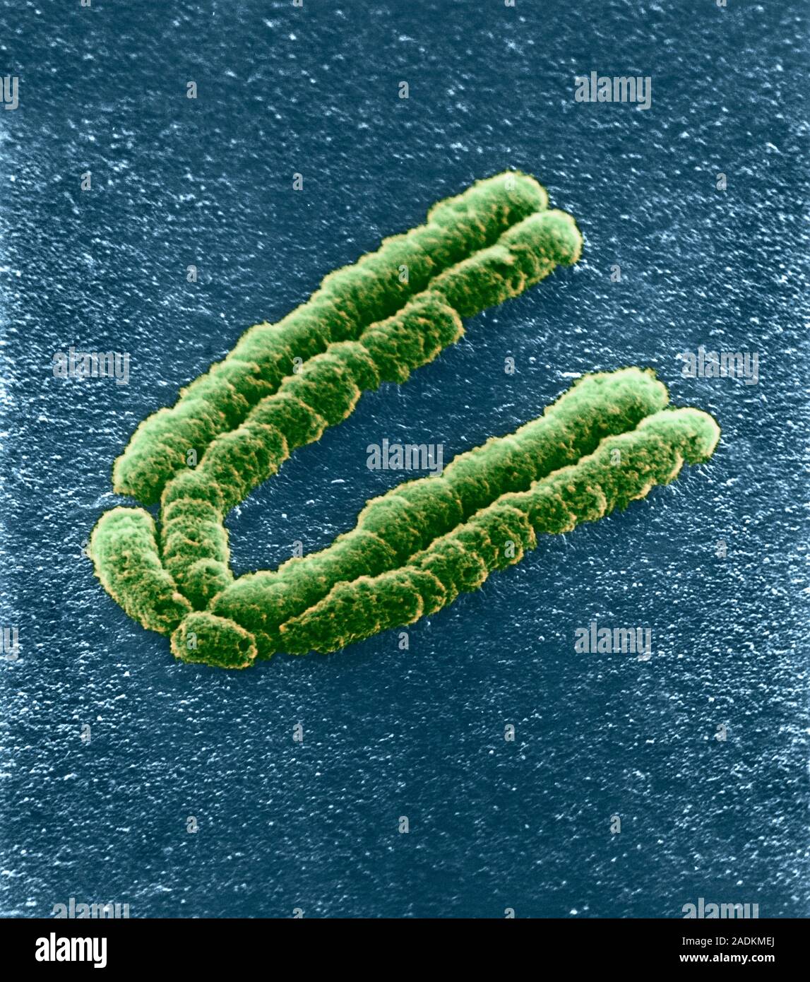 Chromosome. Coloured scanning electron micrograph (SEM) of a chromosome ...
