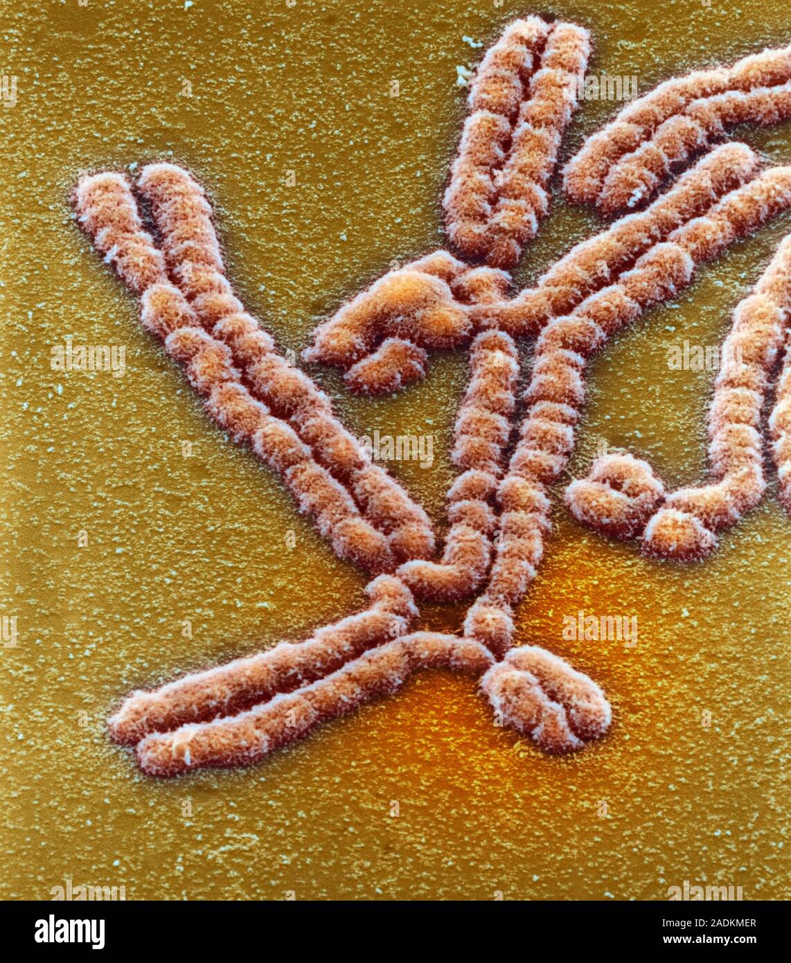 Chromosome rearrangements. Coloured scanning electron micrograph (SEM ...