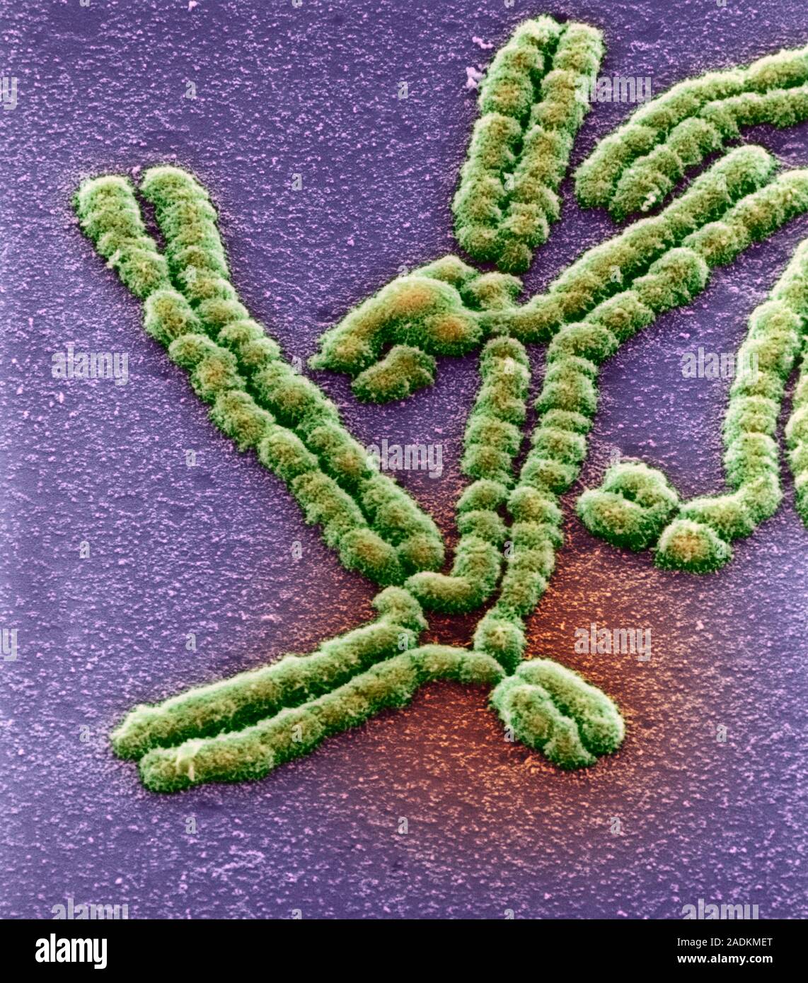 Chromosome rearrangements. Coloured scanning electron micrograph (SEM ...