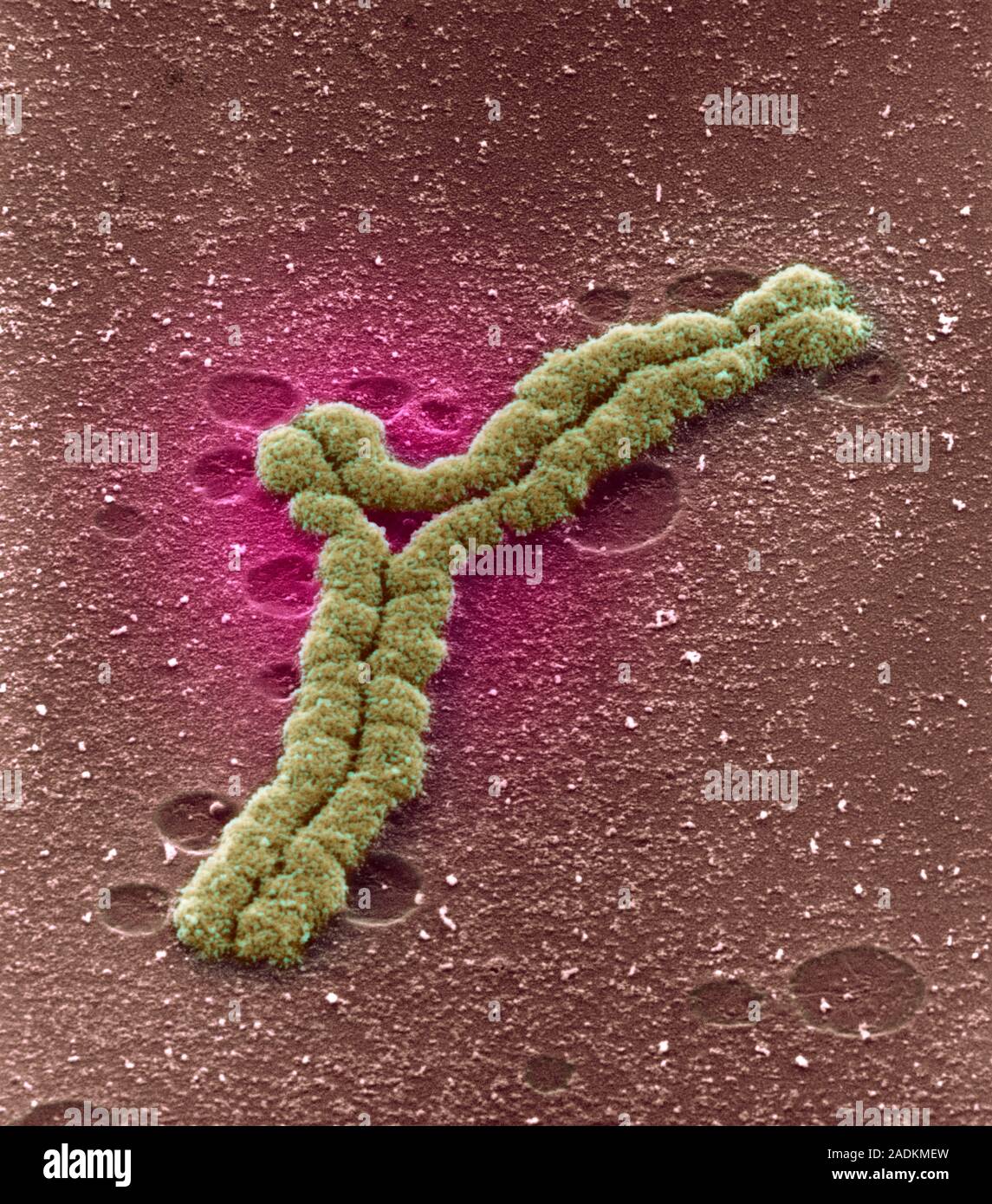 Chromosome rearrangement. Coloured scanning electron micrograph (SEM ...