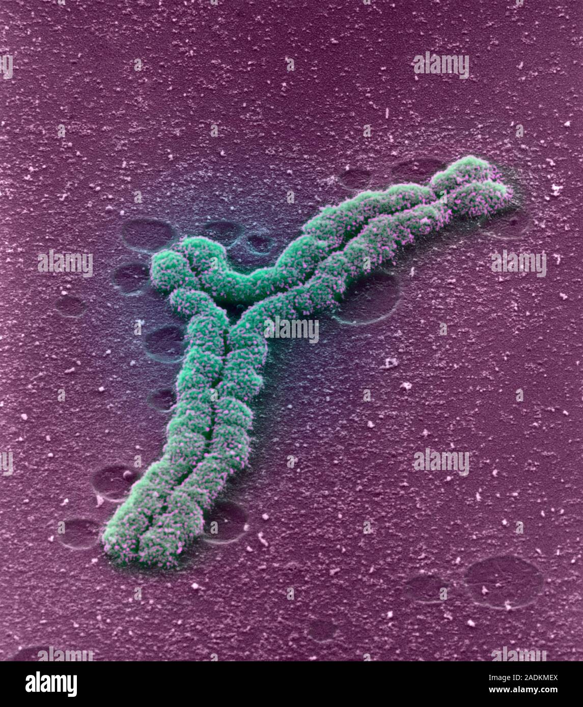 Chromosome rearrangement. Coloured scanning electron micrograph (SEM ...
