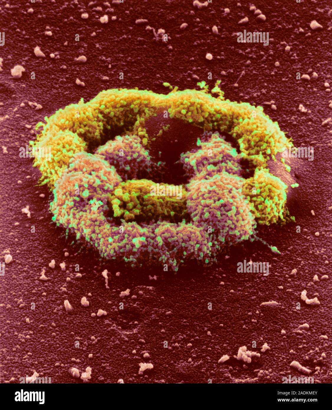 Ring chromosome. Coloured scanning electron micrograph (SEM) of a ...