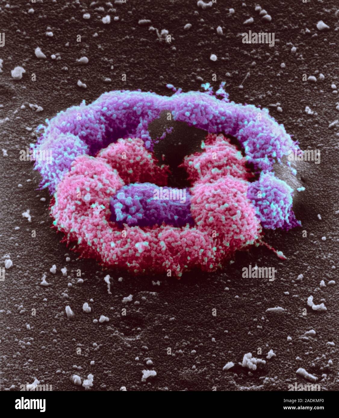 Ring chromosome. Coloured scanning electron micrograph (SEM) of a ...