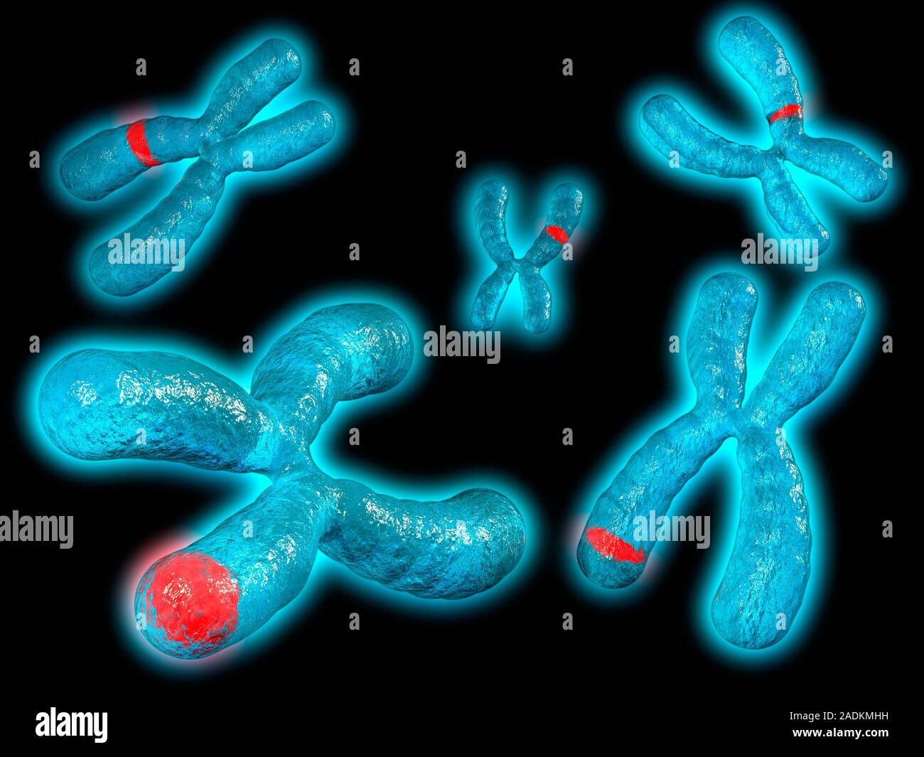 Genetic disease, conceptual computer artwork. Five chromosomes each ...
