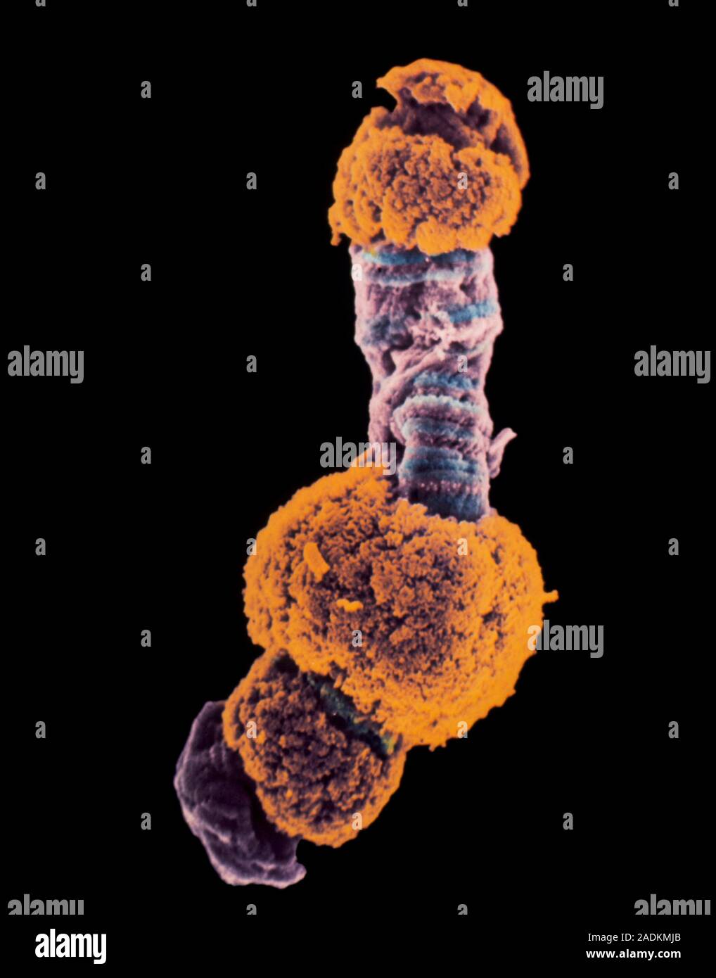 Giant chromosome. Coloured scanning electron micrograph of a giant ...