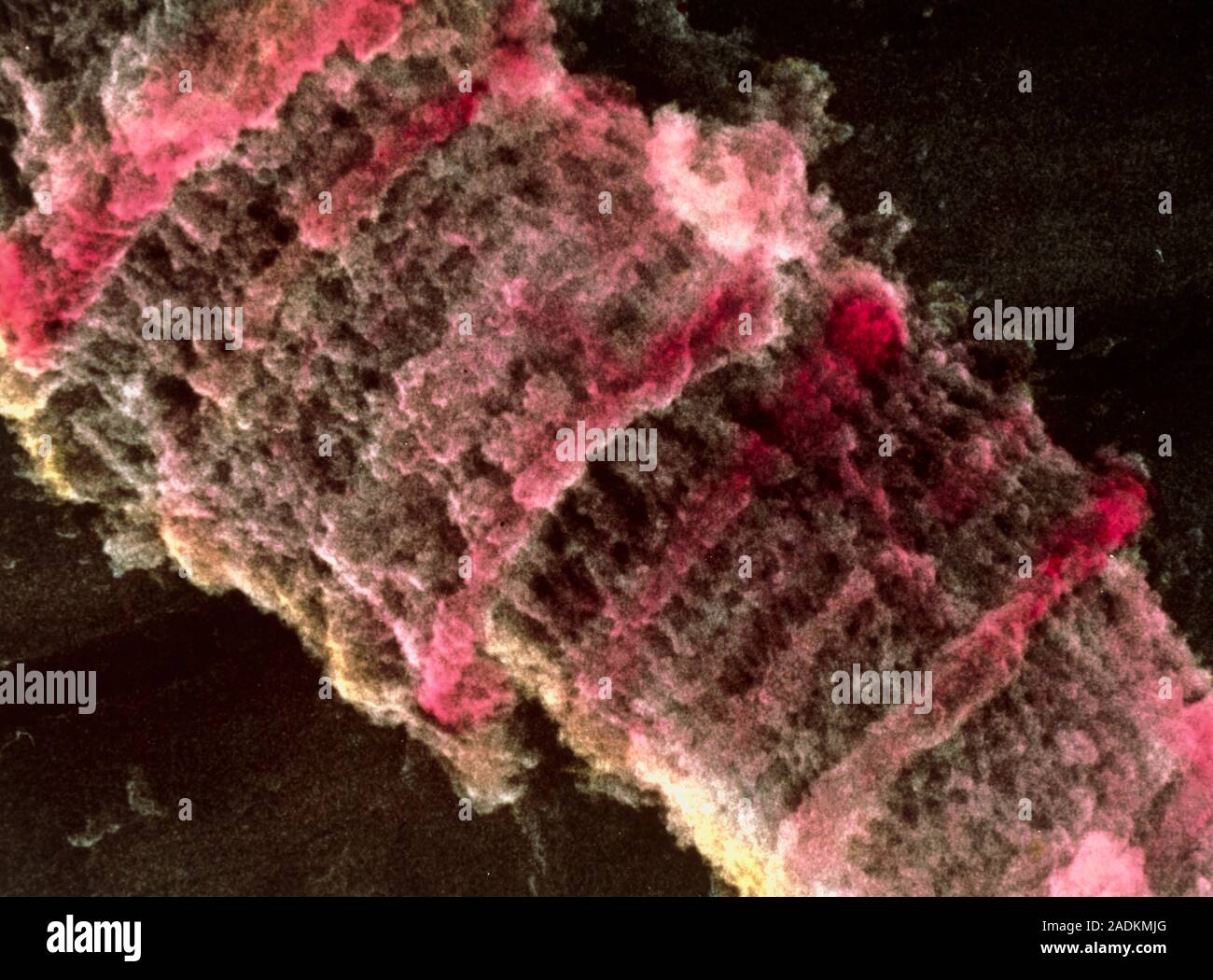 Giant Chromosome Coloured High Resolution Scanning Electron Micrograph Of Part Of A Giant