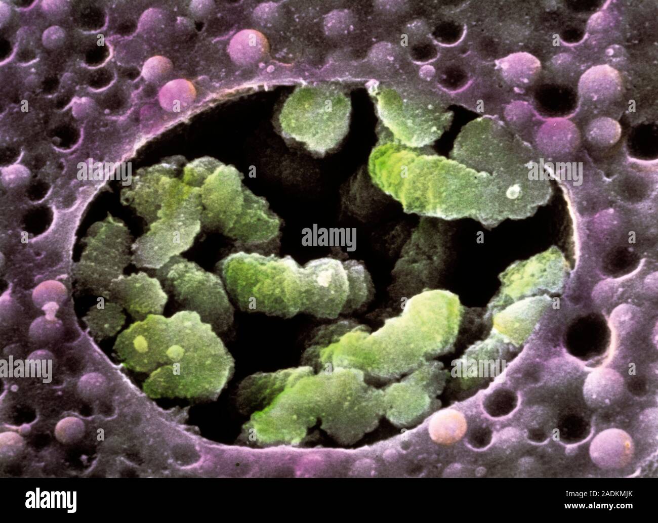 Giant chromosomes. Coloured high resolution scanning electron ...