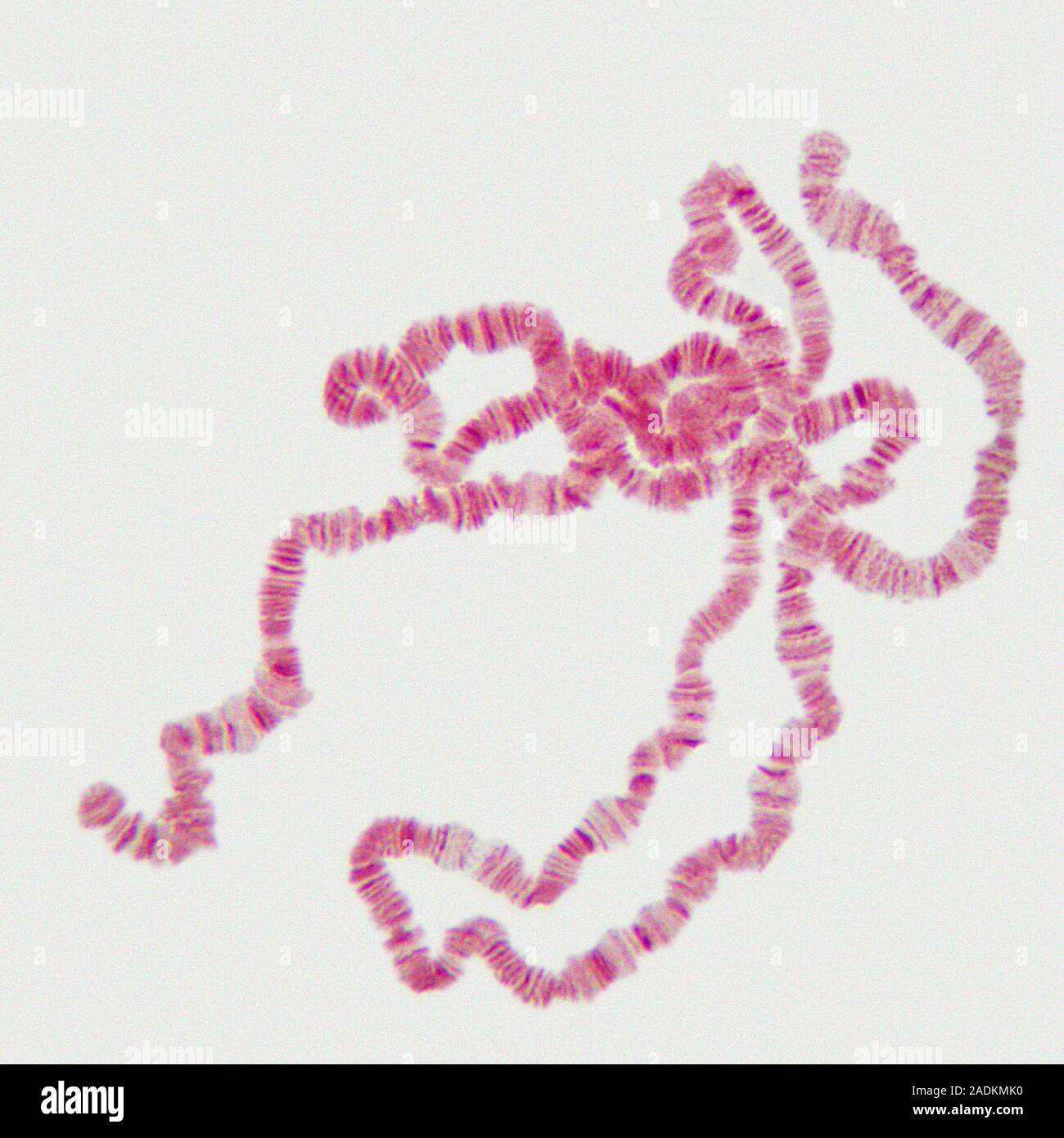 Giant Chromosomes Light Micrograph Of Giant Polytene Chromosomes From A Fruit Fly Drosophila