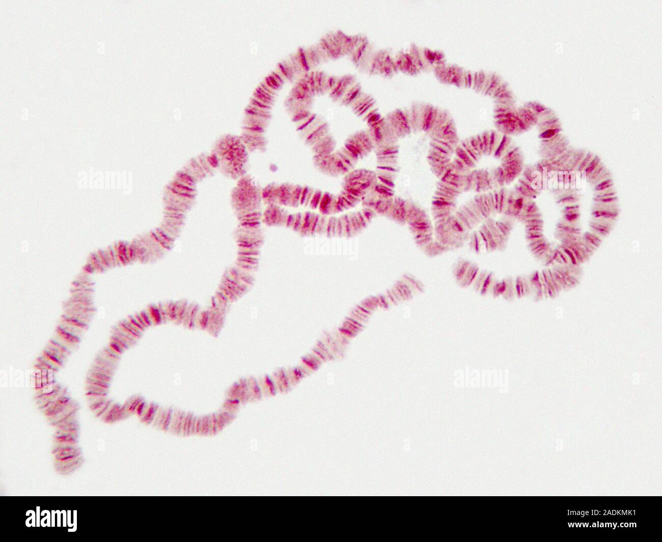 Giant chromosomes. Light micrograph of giant (polytene) chromosomes ...