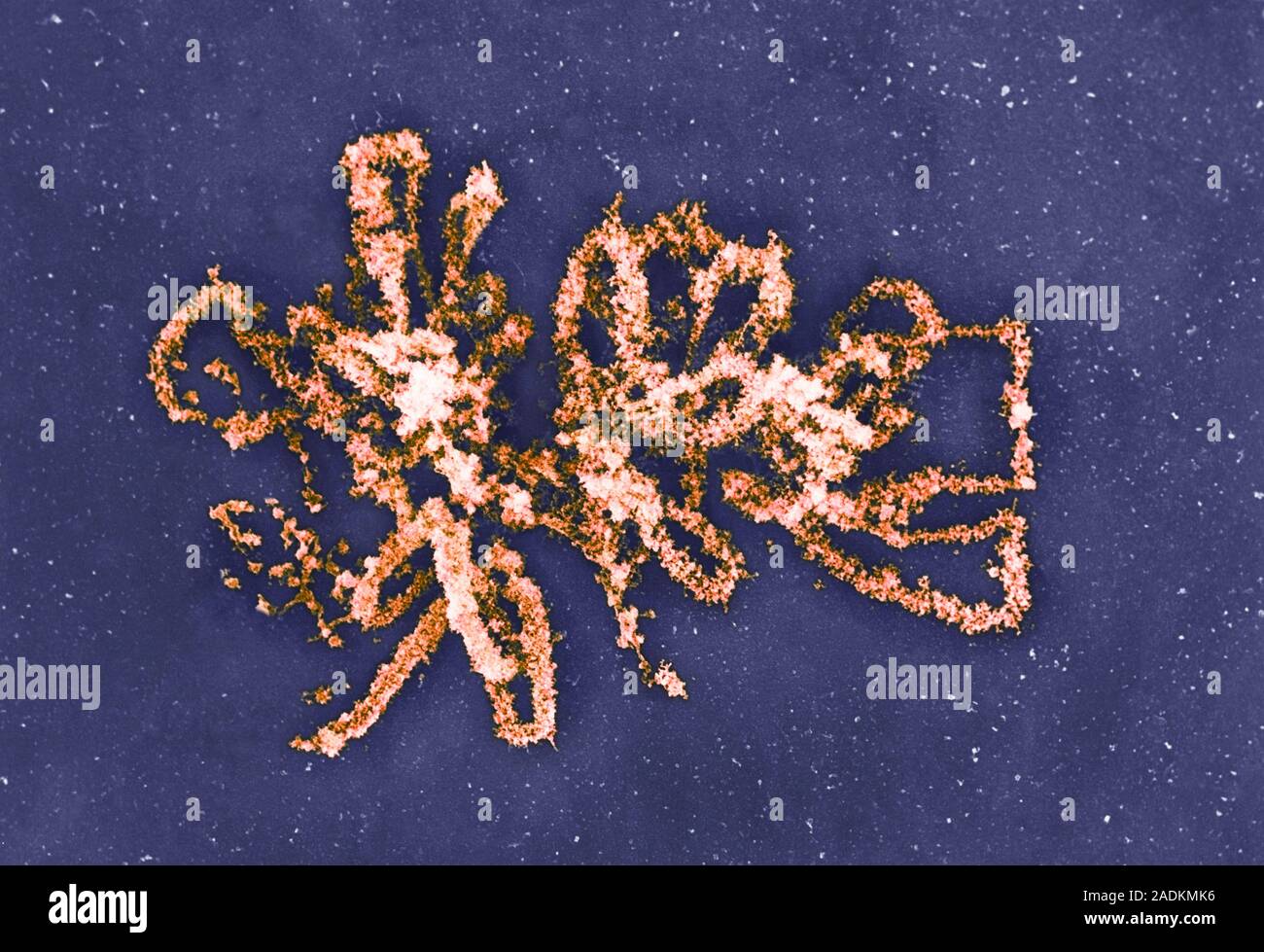 Lampbrush chromosomes. Coloured transmission electron micrograph (TEM ...