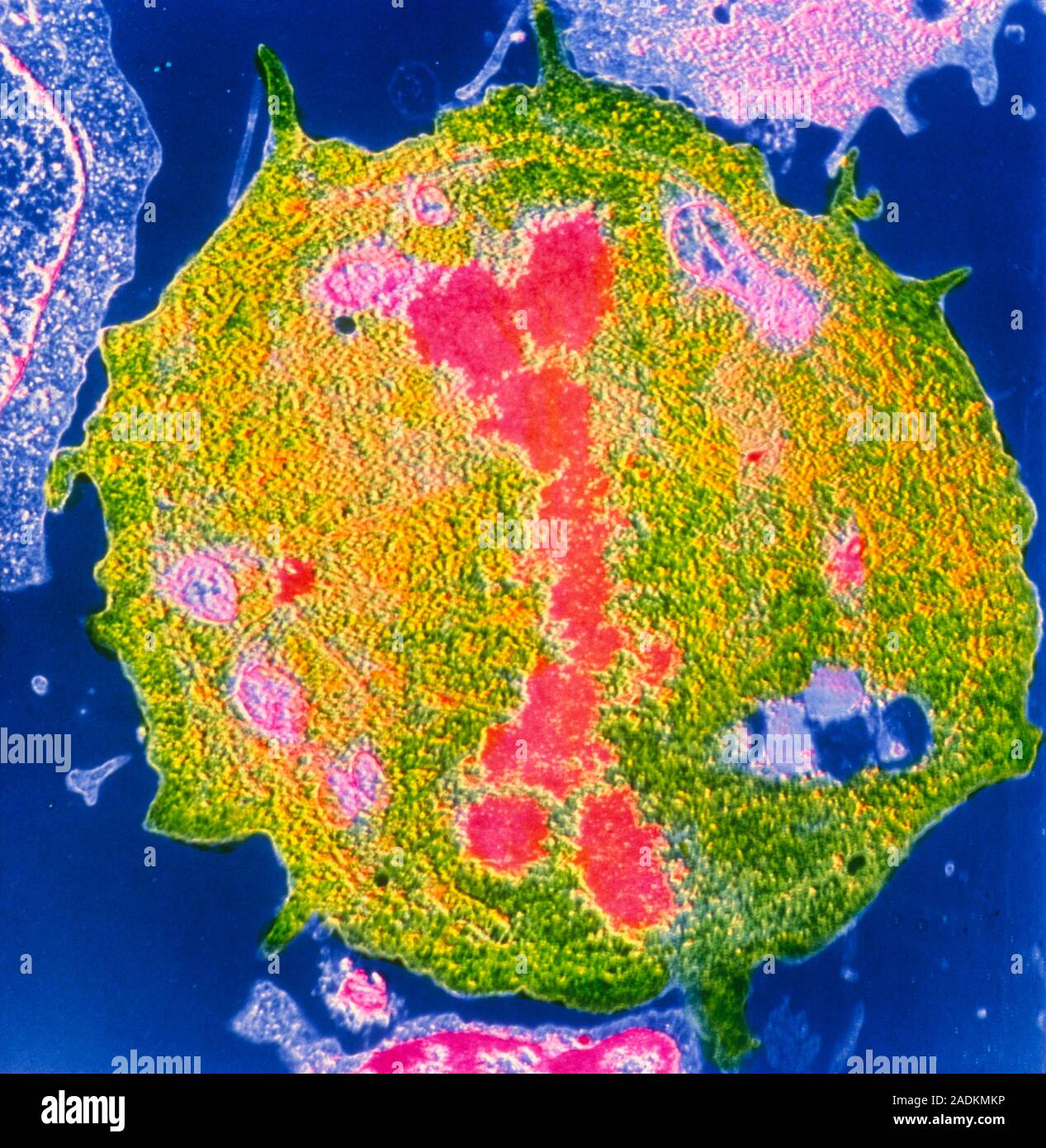 False-colour transmission electron micrograph (TEM) of a human ...
