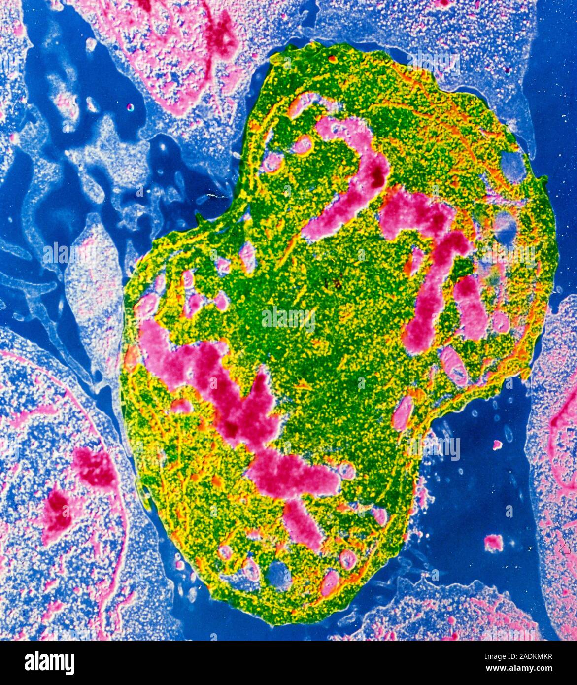 False-colour transmission electron micrograph (TEM) of a human ...