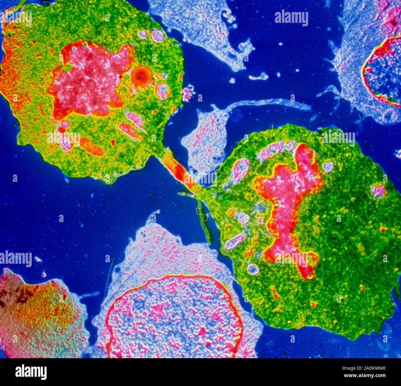 False-colour transmission electron micrograph (TEM) of a human ...
