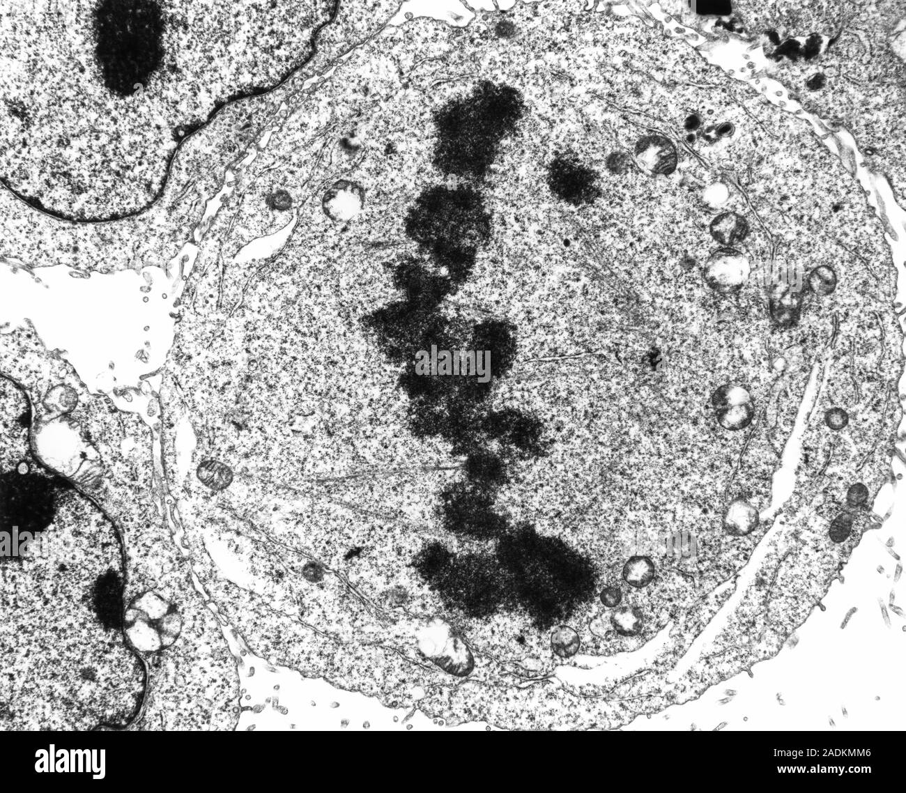 Metaphase cell division. Transmission Electron Micrograph (TEM) of a ...