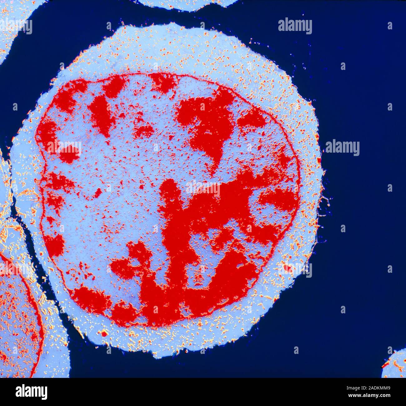 Prophase cell division. Coloured transmission electron micrograph (TEM ...