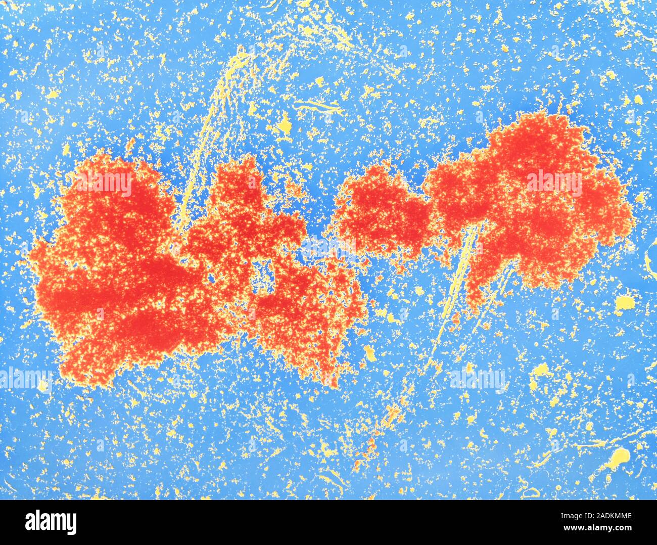 Metaphase cell division. Colour transmission electron micrograph (TEM ...