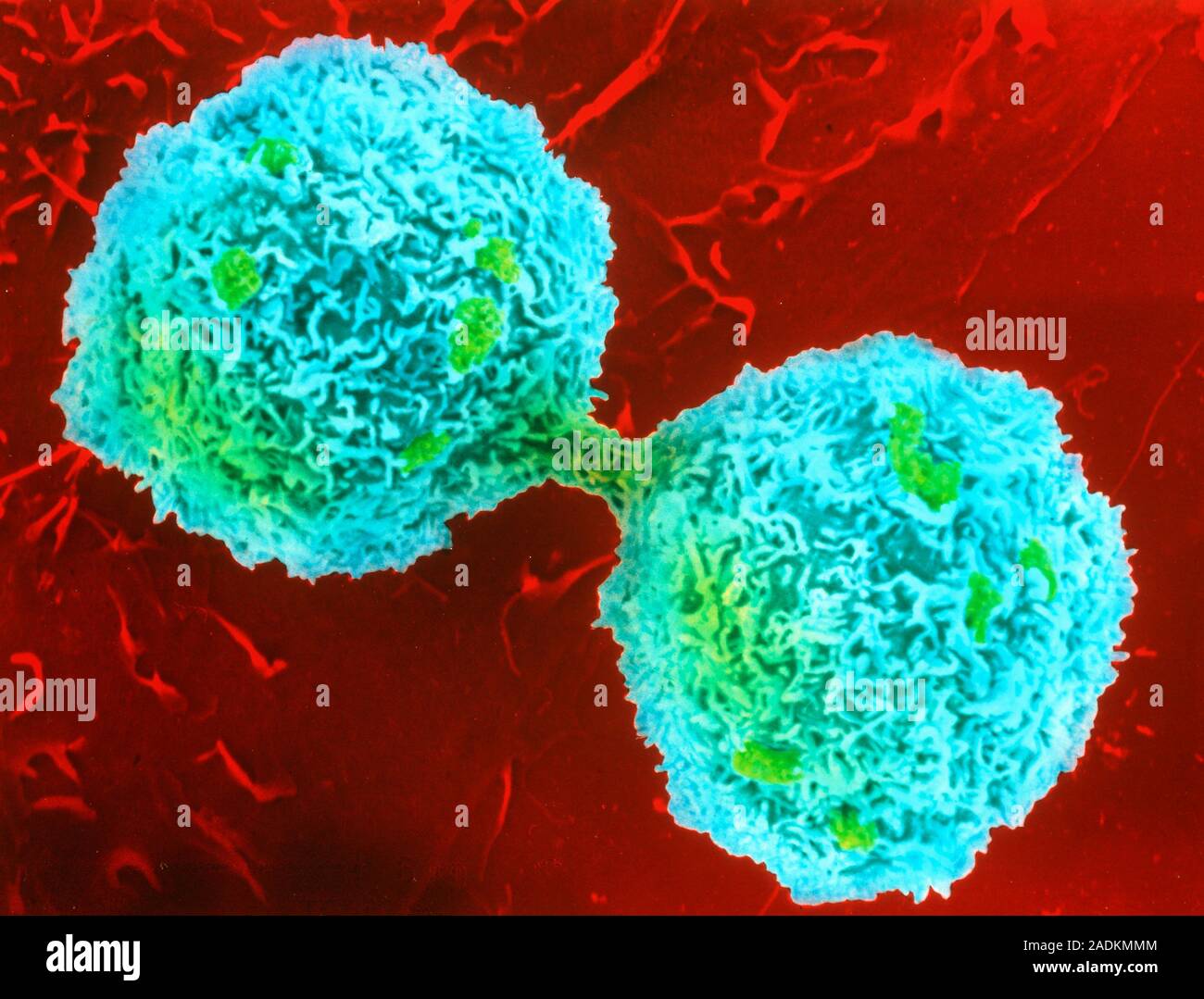Cell division. Coloured scanning electron micrograph (SEM) of a ...