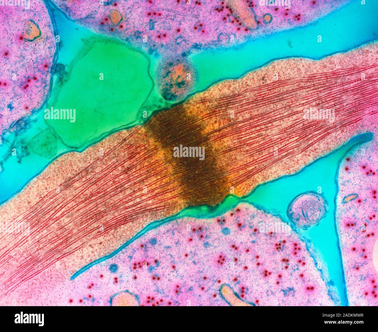 Cytokinesis cell division. Coloured transmission electron micrograph ...