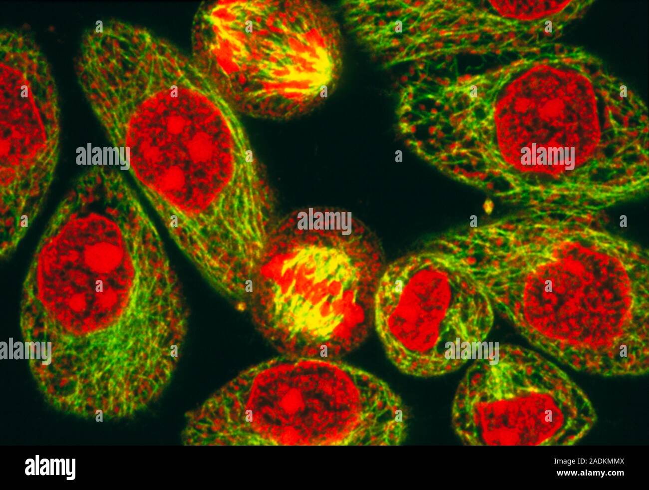 Mitosis. Immunofluorescent light micrograph of HeLa cancer culture ...
