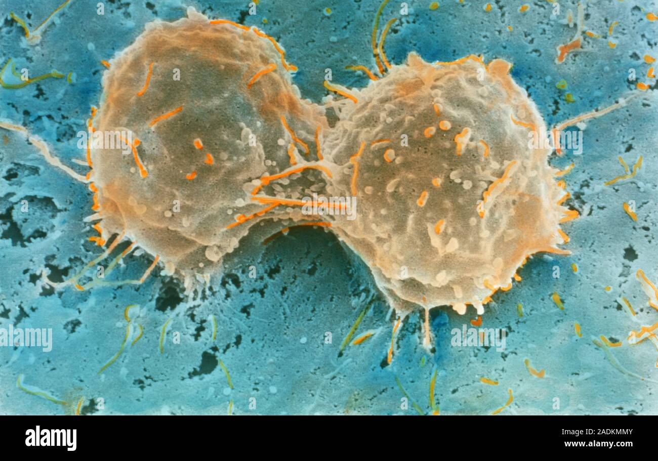 Cell division. Coloured scanning electron micrograph (SEM) of a ...