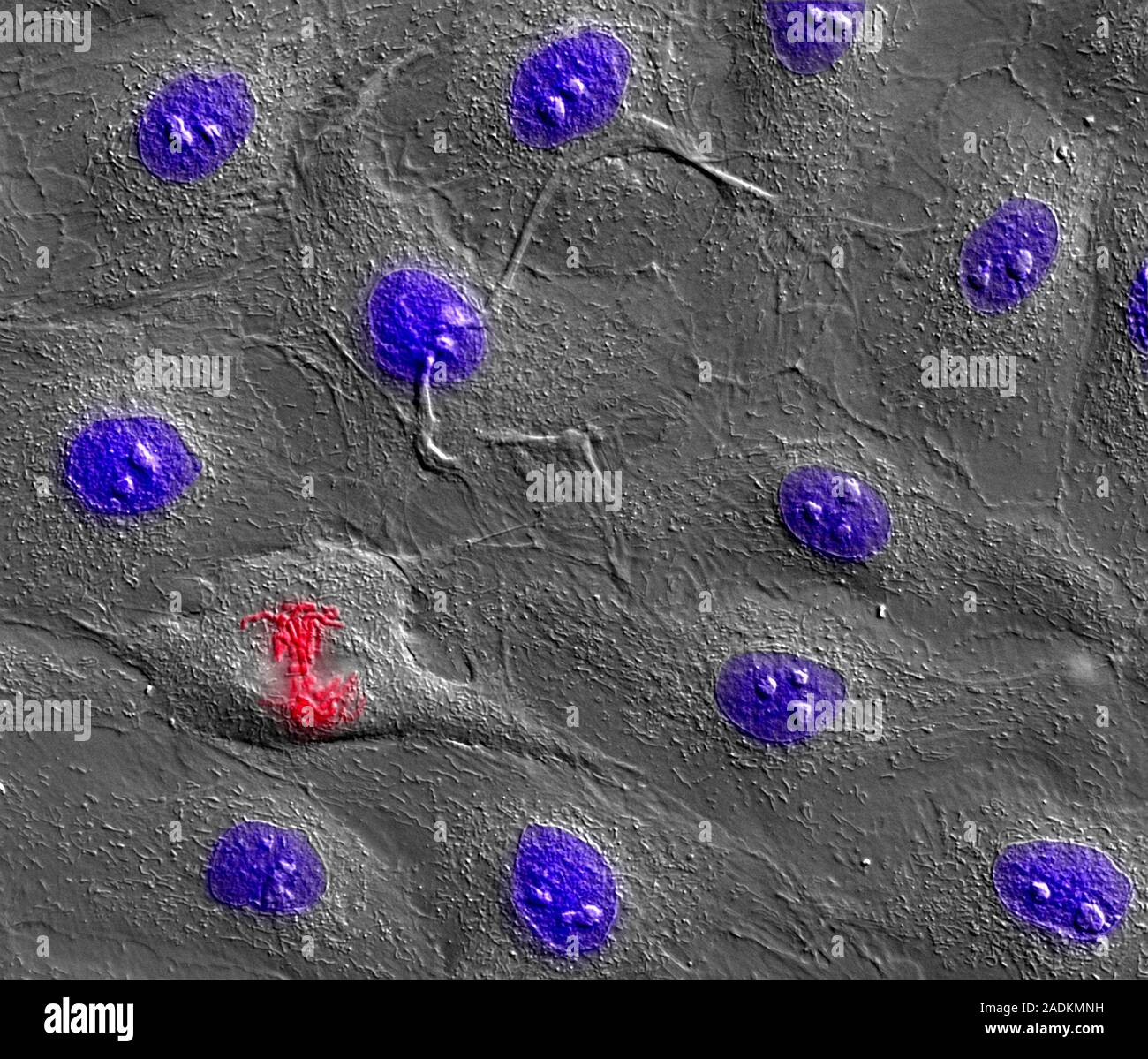 Dividing cell. Differential interference contrast (DIC) light ...