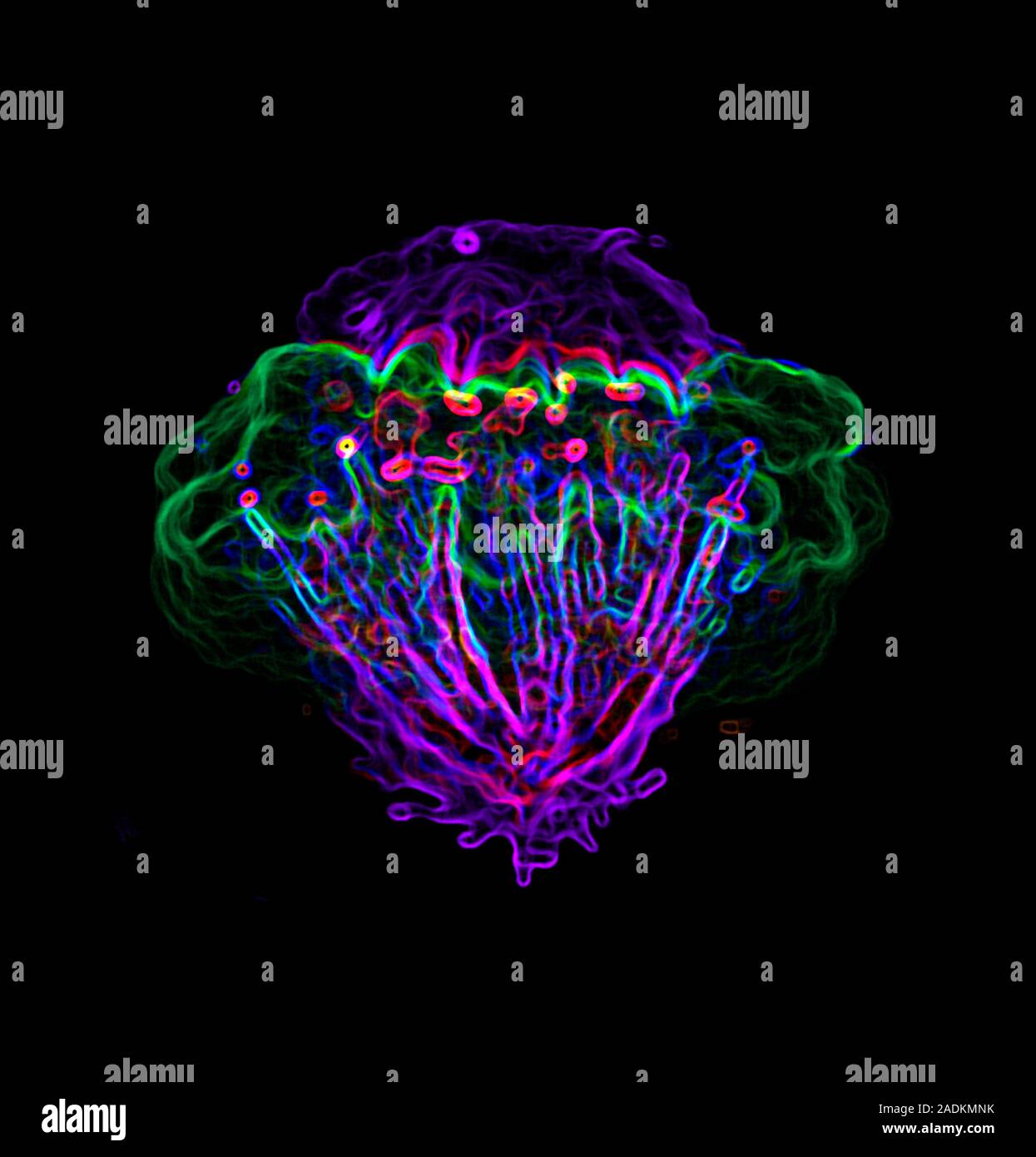 Mitosis. Fluorescence micrograph of abnormal metaphase during mitosis ...