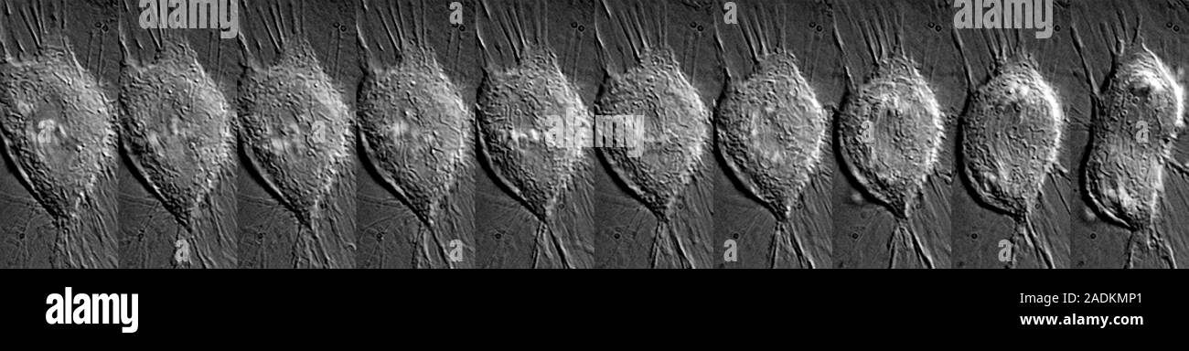 Cell division. Time-exposure light micrograph showing the different ...