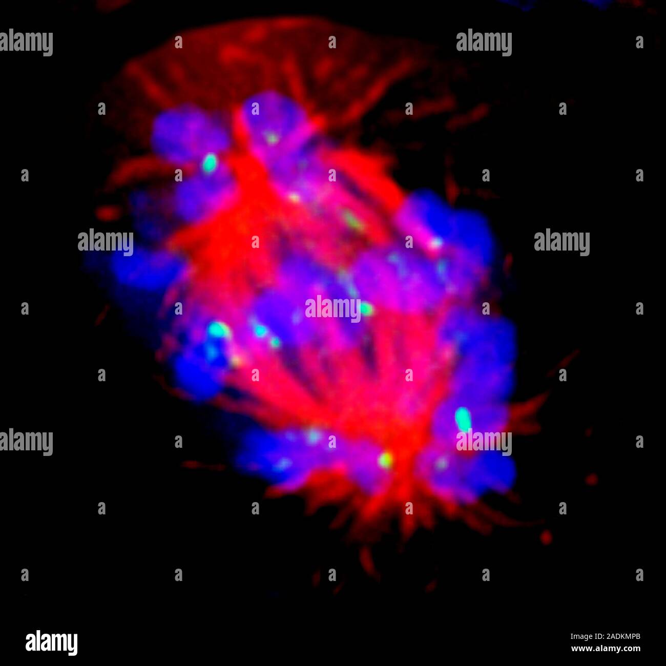 Mitosis. Fluorescence micrograph of a cell during abnormal anaphase of ...