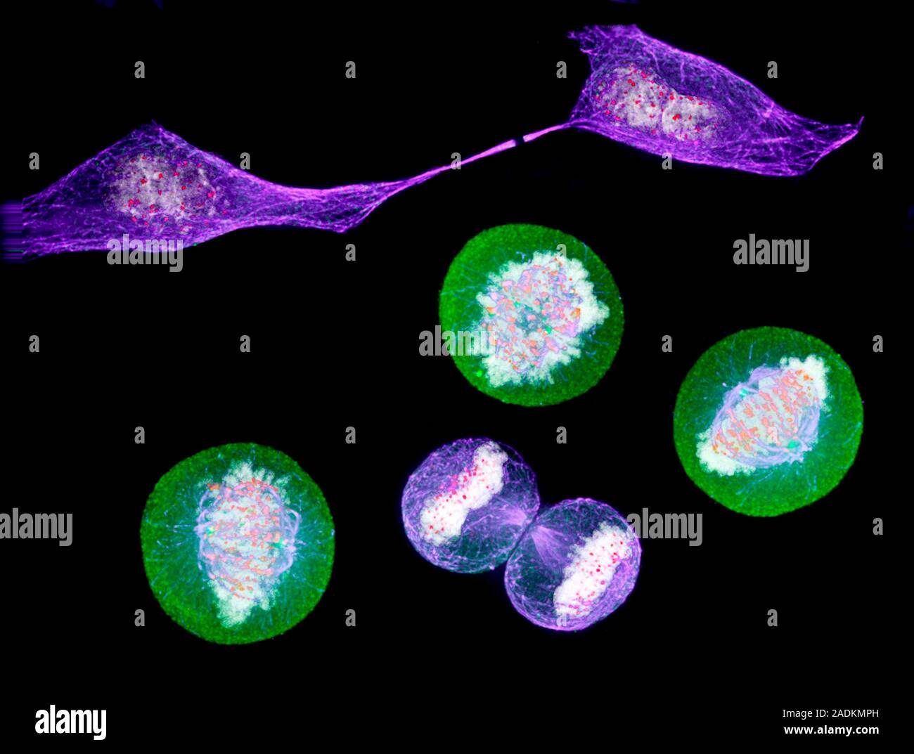 Cell division. Immunofluorescent light micrograph of five HeLa cancer ...