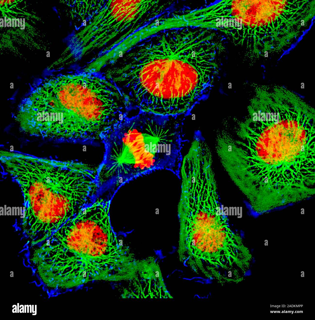Cell division. Immunofluorescent light micrograph of a cell (centre ...