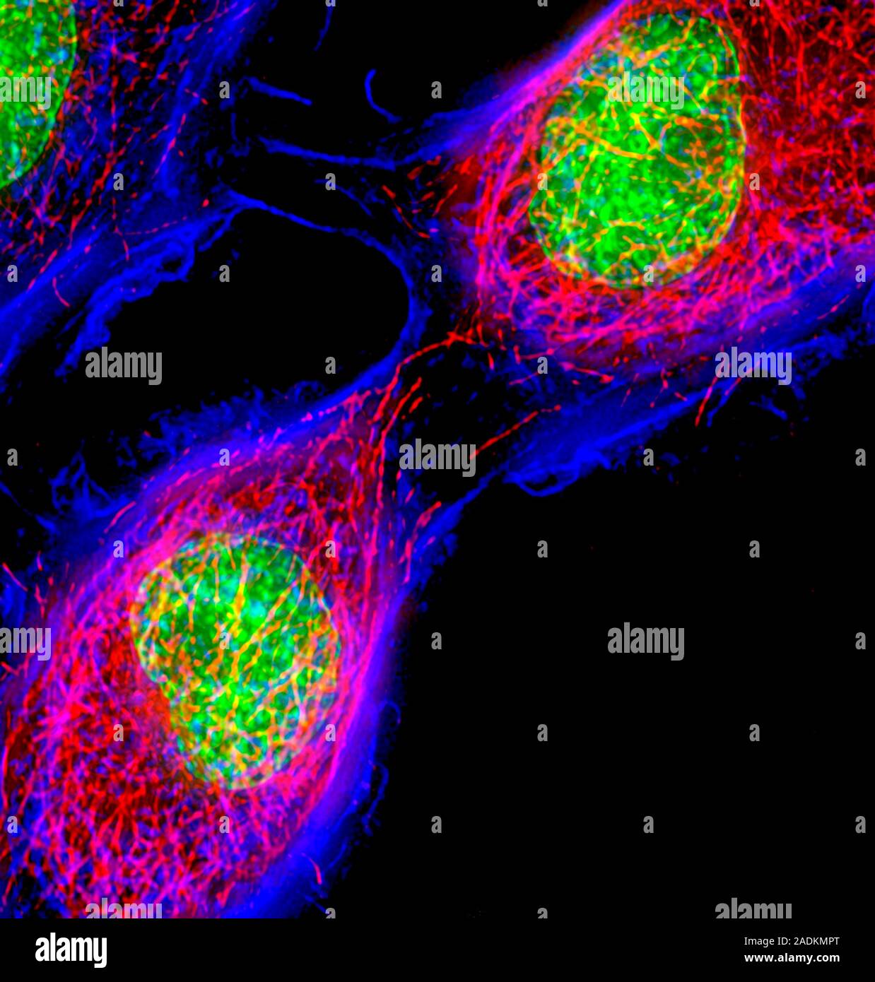 Cell division. Immunofluorescent light micrograph of a cell during ...