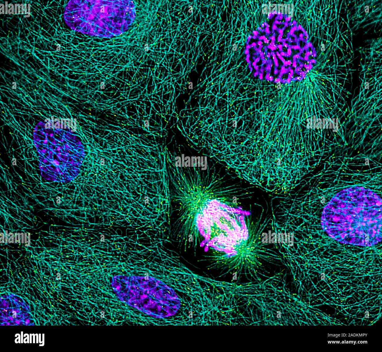 Mitosis. Immunofluorescence light micrograph of a cell (lower right) in ...