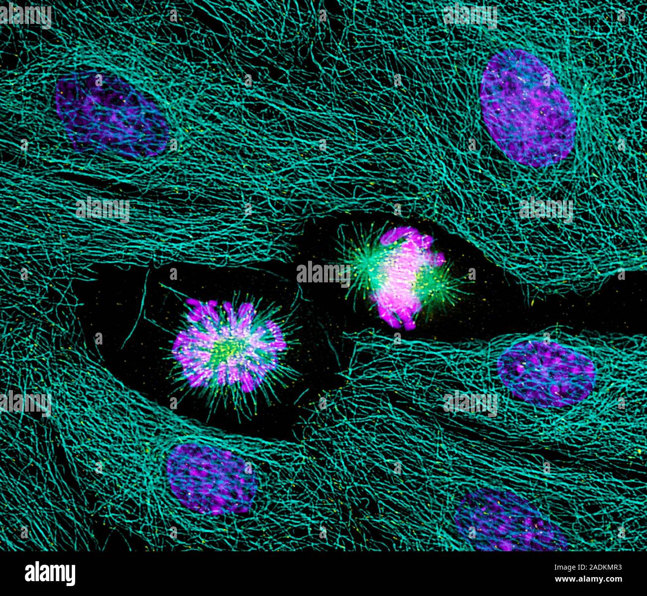 Mitosis. Immunofluorescence light micrograph of two cells during ...