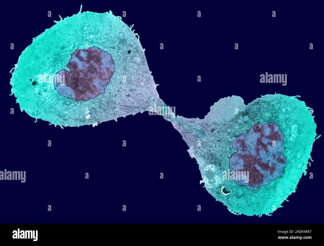 Mitotic cell division. Coloured transmission electron micrograph (TEM ...