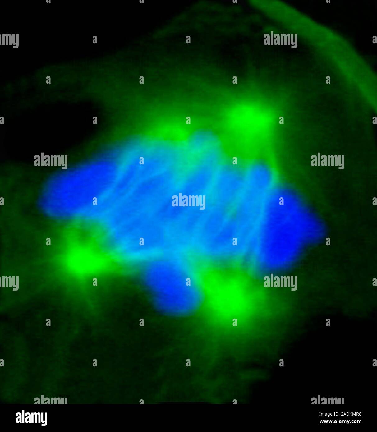 Abnormal mitosis. Fluorescence micrograph of a cell during an abnormal ...