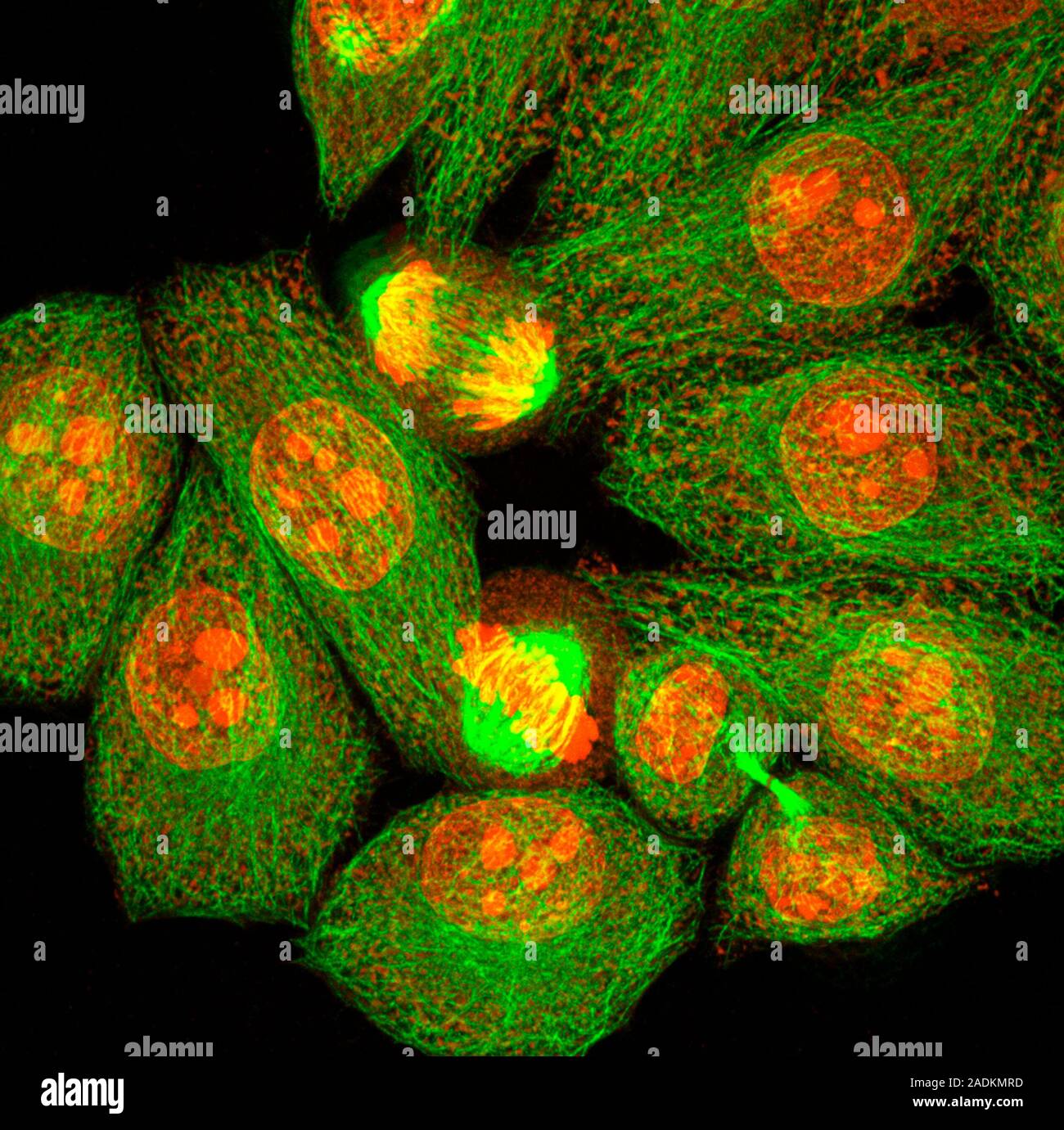 Mitosis. Confocal light micrograph of HeLa cells during mitosis ...