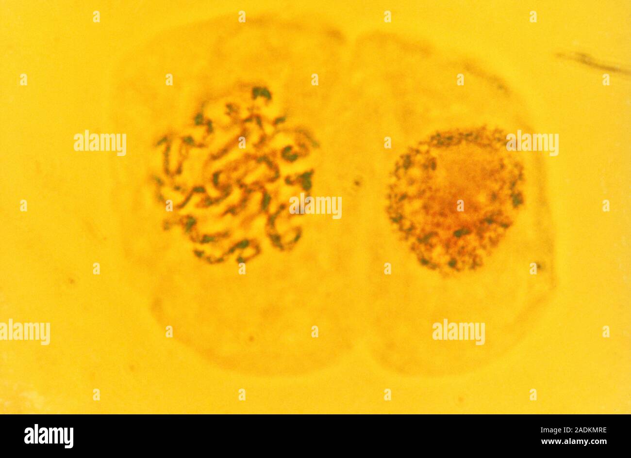 Mitosis, Light micrograph. The cell at right is in interphase, the ...