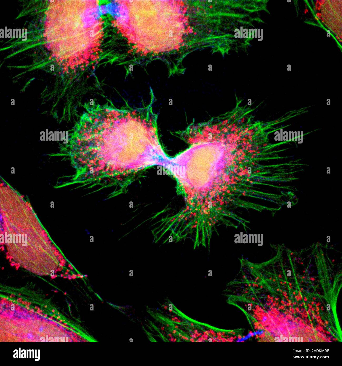 Cell division. Confocal light micrograph of a HeLa cell during ...