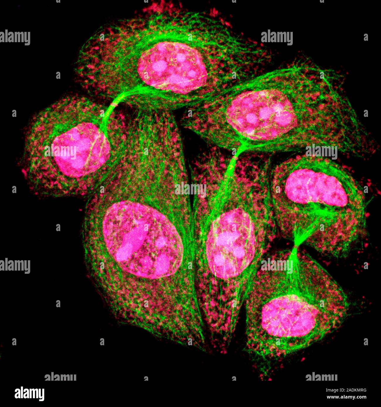 Cell division. Confocal light micrograph of a HeLa cell during ...