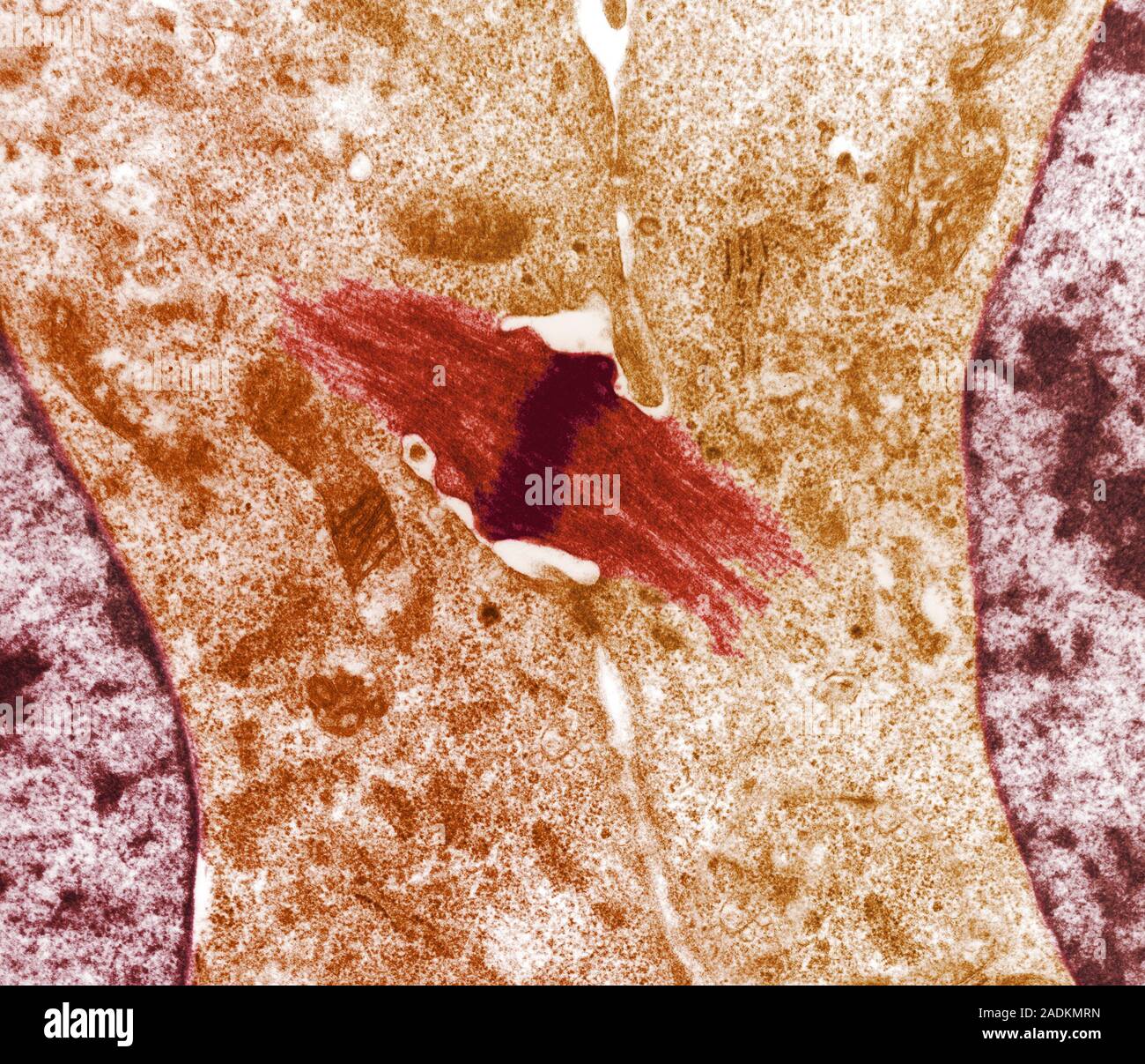 Mitotic cell division. Coloured transmission electron micrograph (TEM ...