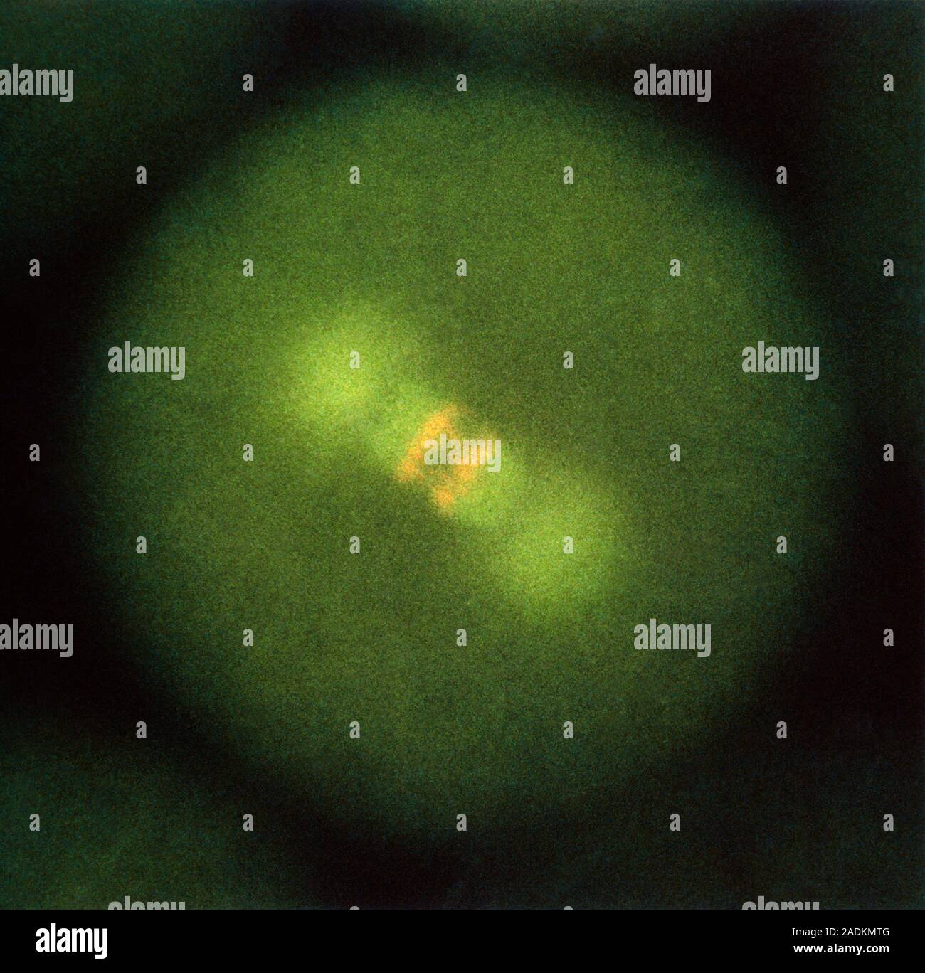 Double staining of DNA and microtubules of sea urchin. Anaphase of cell ...