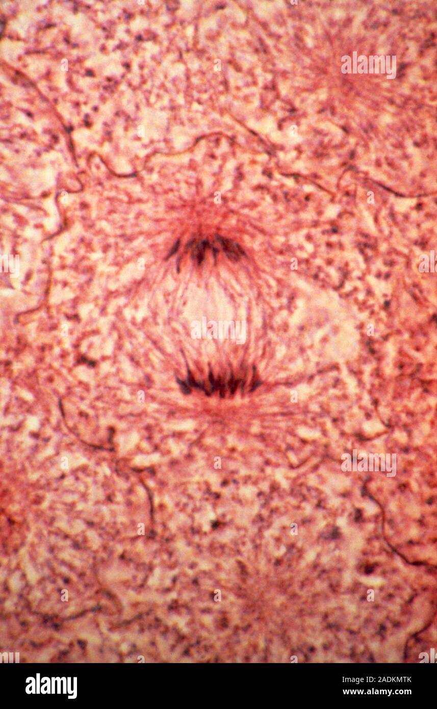 Anaphase of cell mitosis. Light micrograph of a whitefish cell ...